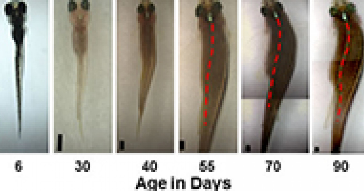 Untwist scoliosis by clipping wings of an overactive ladybird | KYOTO ...